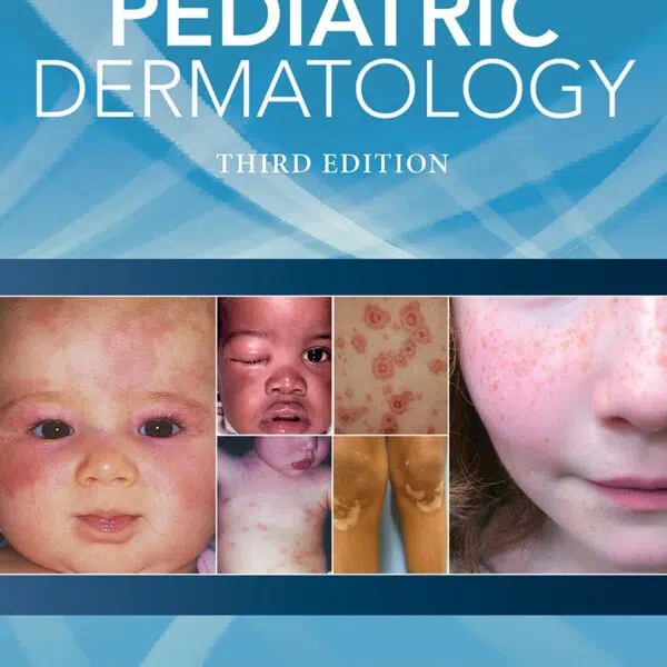 Illustrated Manual of Pediatric Dermatology: Diagnosis and Management ...